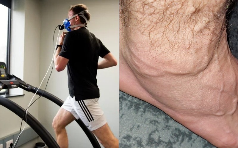 London Marathon Week 12: Disaster strikes with the old David Dunn injury